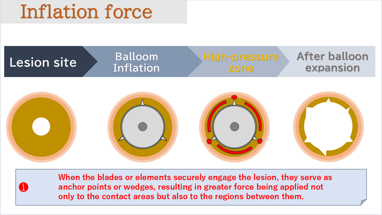 Types and Basics of Cutting and Scoring Balloons【for PCI】 | カンペの獣